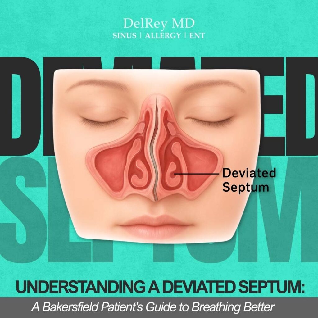 🩺 Understanding a Deviated Septum: A Bakersfield Patient’s Guide to Breathing Better - Del Rey ...